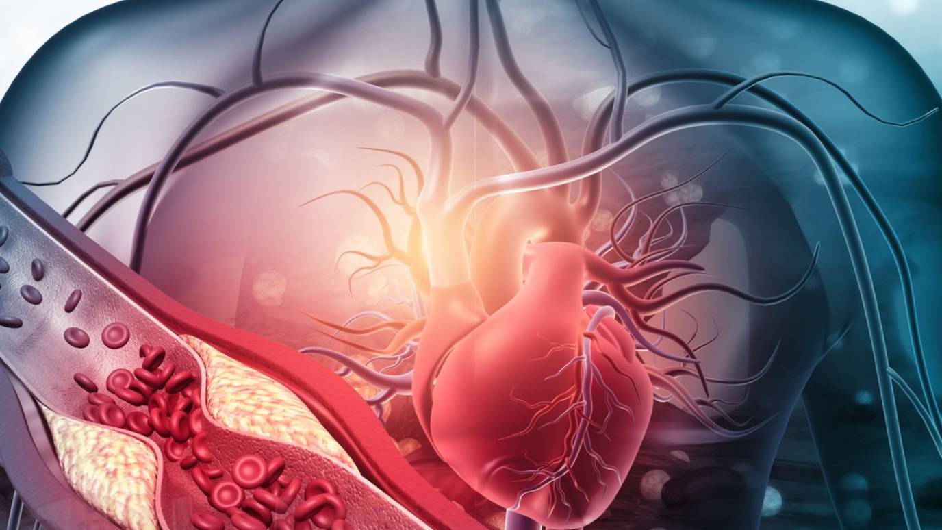 Comparison of Proximal Optimisation with Kissing Inflation Technique ...