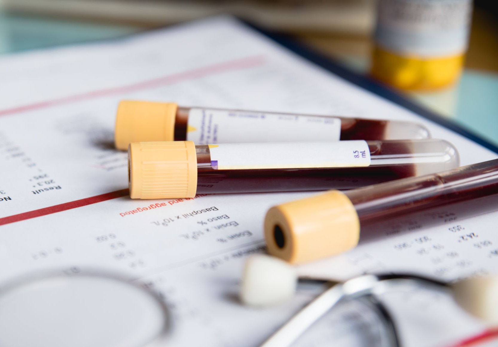 Two-Step Screening Strategy Could Reduce Diabetic Heart Failure ...