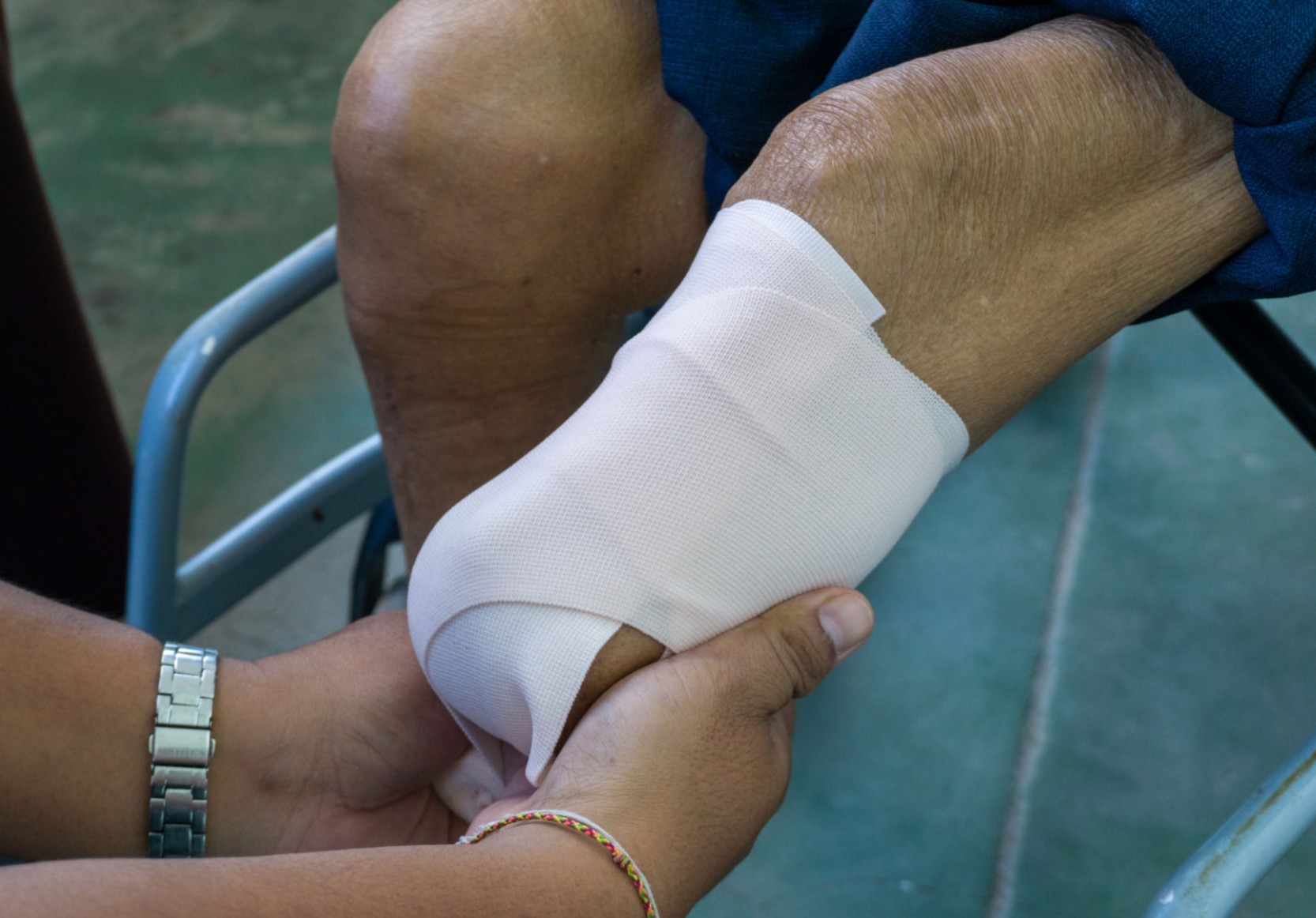 People in Their 50s with PAD Found to Be at Higher Amputation Risk Than ...